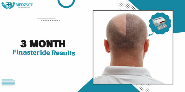 3 Month Finasteride Results